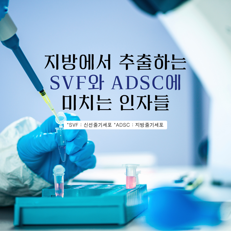 지방에서 추출하는 SVF와 ADSC에 미치는 인자들 > 미다스칼럼 | 미다스성형외과 줄기세포가슴성형